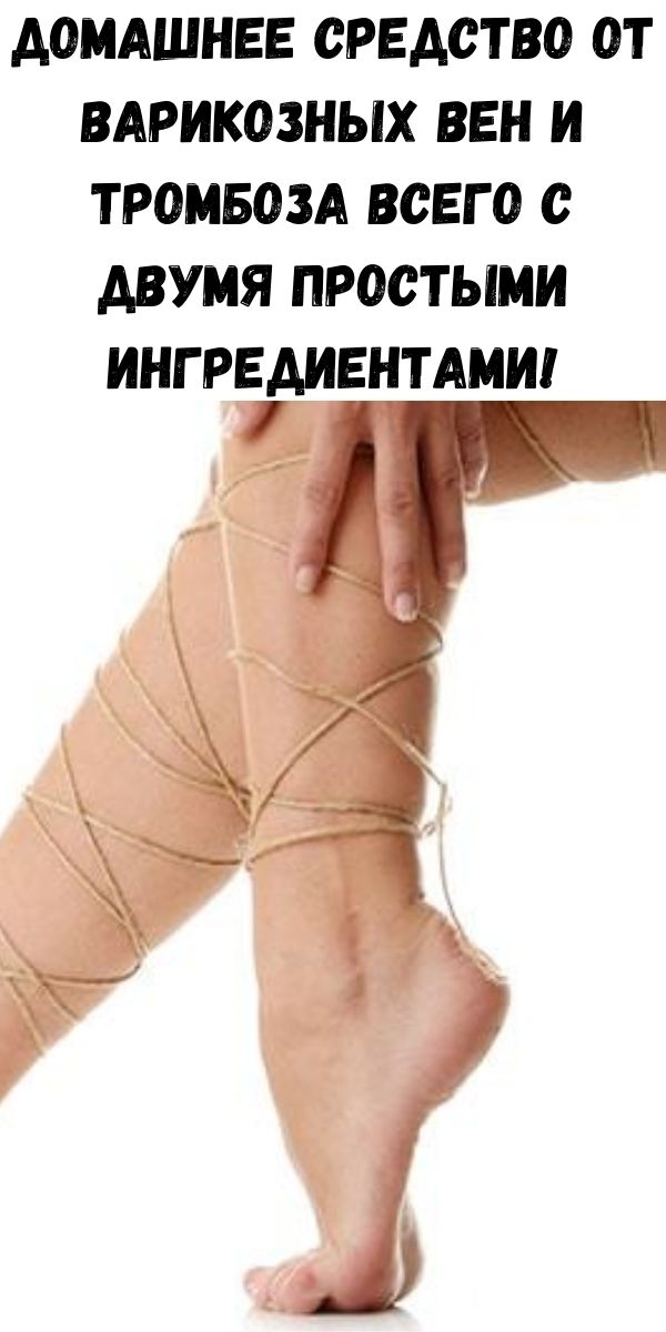 Домашнее средство от варикозных вен и тромбоза всего с двумя простыми ...